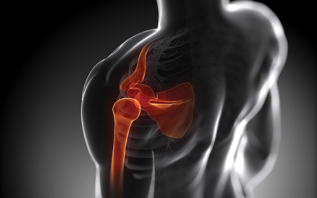 Shoulder Pain, And How To Prevent The Three Most Common Causes. - The ...